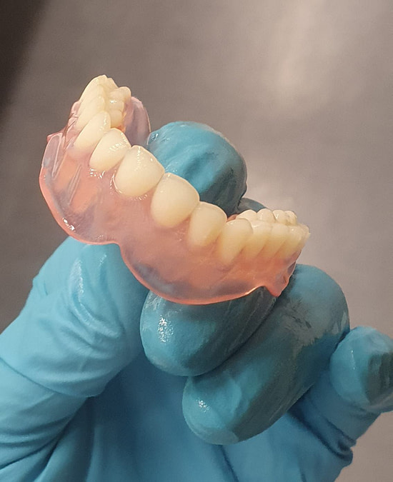 Are Jetted Multi-Material Monolithic Digital Dentures the Future of ...