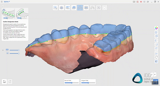 Medit i700 Wireless Intraoral Scanner Review + Medit Apps