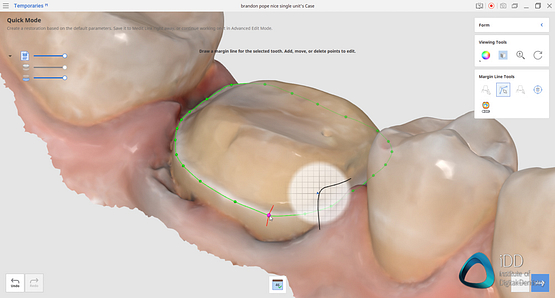 Medit i700 Wireless Intraoral Scanner Review + Medit Apps