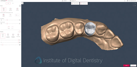 CAD Software in Dentistry - How Everything is Going to the Cloud
