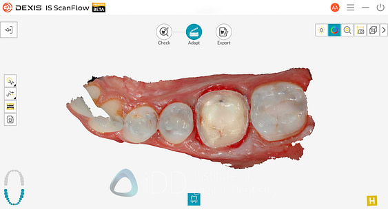 DEXIS IS 3800 Wireless Intraoral Scanner Review by iDD