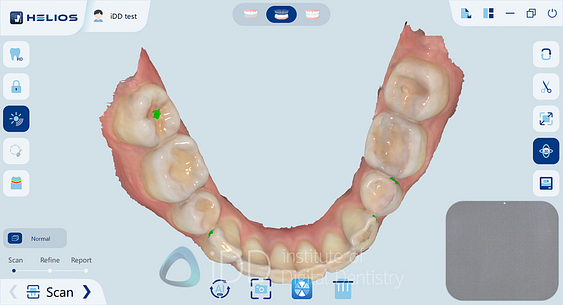 Helios 500 Intraoral Scanner Review