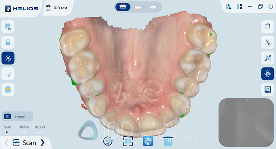 Helios 500 Intraoral Scanner Review