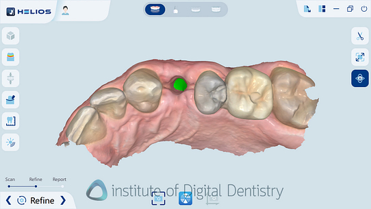 Helios 500 Intraoral Scanner Review