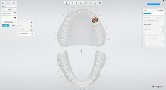 Dental Implant Treatment from Start to Finish using 3Shape TRIOS