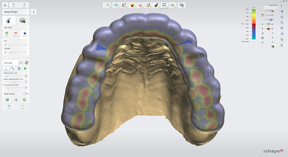 From Scan to Splint: A Step-by-Step 3Shape TRIOS Case Study - Institute ...