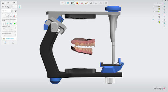 From Scan to Splint: A Step-by-Step 3Shape TRIOS Case Study - Institute ...
