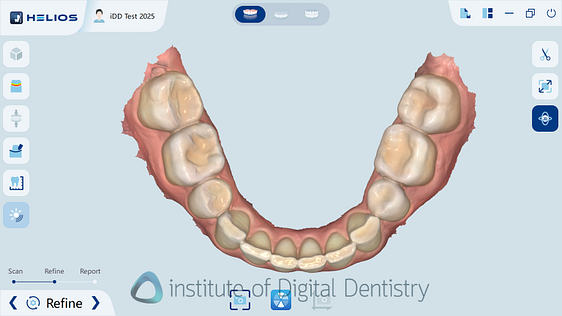 Helios 500 Intraoral Scanner Review