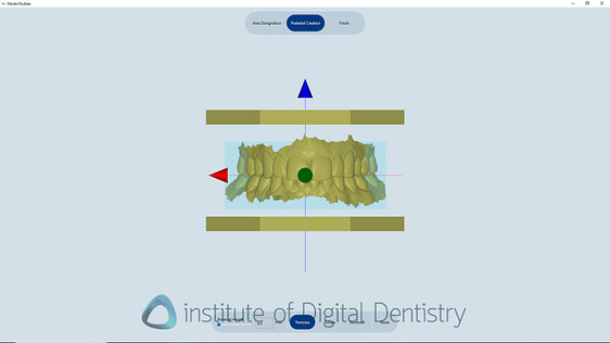 Helios 500 Intraoral Scanner Review