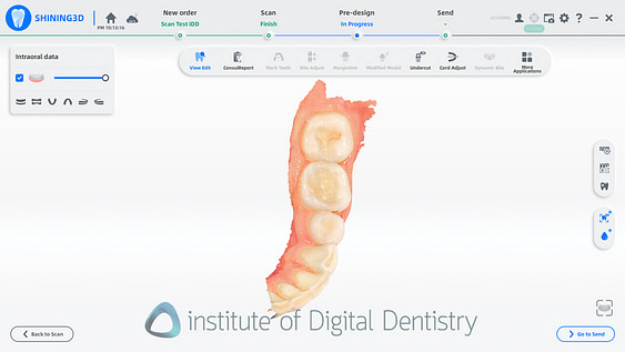 Shining 3D Aoralscan Elite Review by iDD