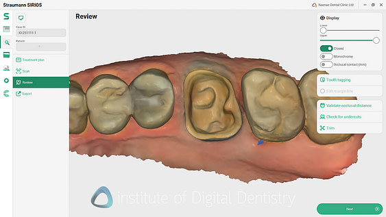 Straumann SIRIOS X3 Intraoral Scanner Review by iDD