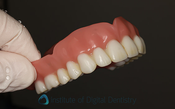 How Accurate Is Edentulous Scanning with Intraoral Scanners?