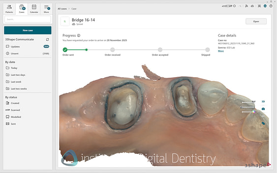 3Shape TRIOS 6 Intraoral Scanner Review by iDD