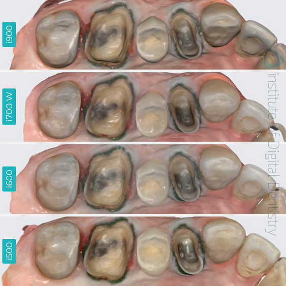 Medit i700 Wireless Intraoral Scanner Review + Medit Apps