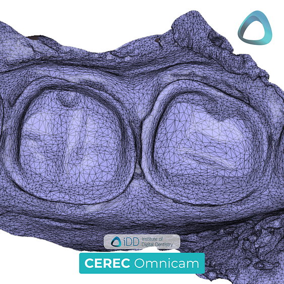 CEREC Omnicam vs. CEREC Primescan vs. Medit i900