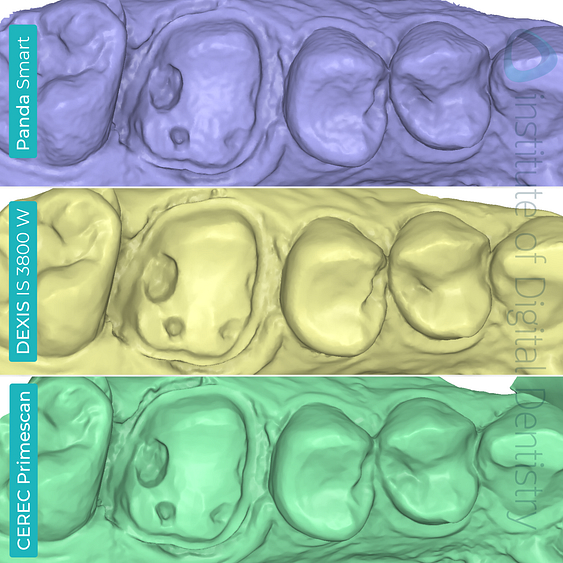Panda Smart vs. DEXIS IS 3800 W vs. CEREC Primescan