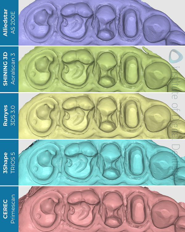 iDD Compares: Affordable vs Expensive Intraoral Scanners - Institute of ...