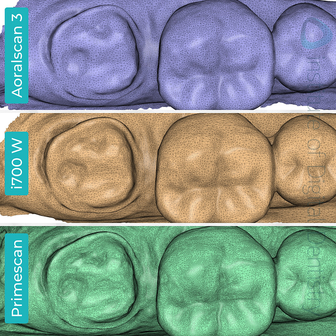 iDD Compares: Aoralscan 3 vs. i700 Wireless vs. Primescan