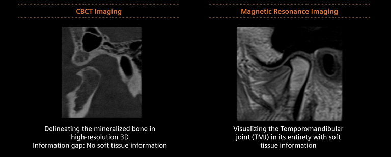 Dentsply Sirona's New Dental MRI Collaboration
