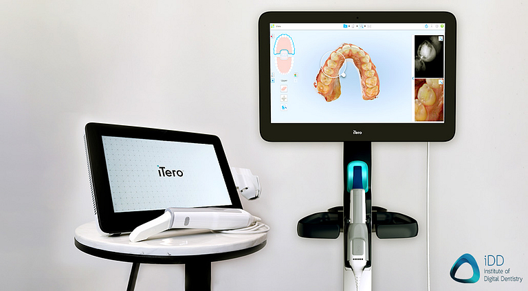 iTero Element 5D Plus Review | Digital Dentistry Blog | Online Courses