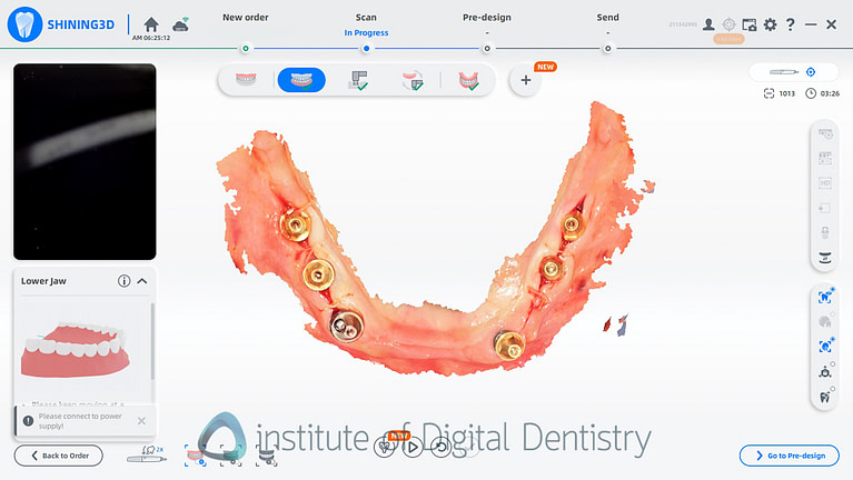 Shining 3D Aoralscan Elite Review by iDD