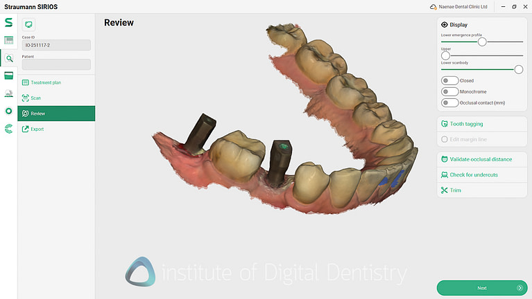 Straumann SIRIOS X3 Intraoral Scanner Review by iDD