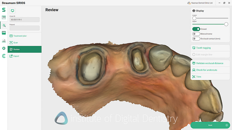 Straumann SIRIOS X3 Intraoral Scanner Review by iDD