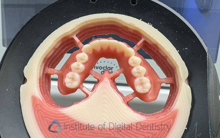 How Accurate Is Edentulous Scanning with Intraoral Scanners?