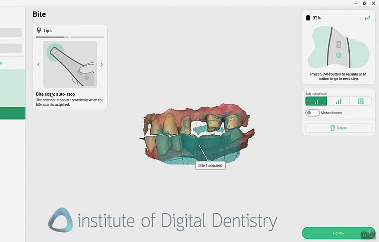 Straumann SIRIOS Intraoral Scanner Review by iDD