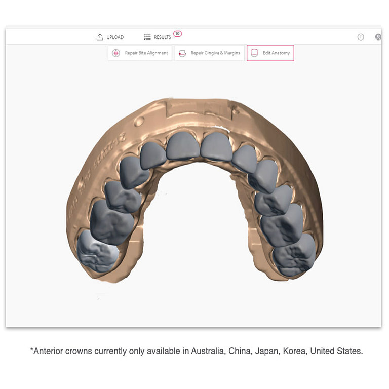 3Shape TRIOS 5 Intraoral Scanner Review by iDD