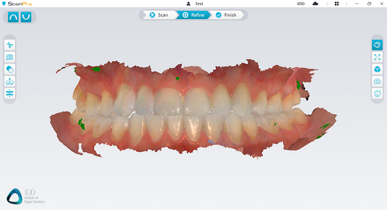 Alliedstar AS100 Intraoral Scanner Review | Institute of Digital Dentistry