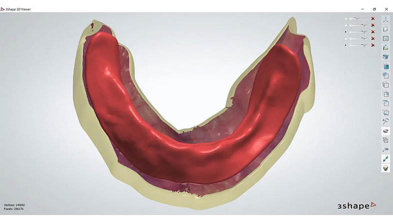 3Shape TRIOS 5 Intraoral Scanner Review