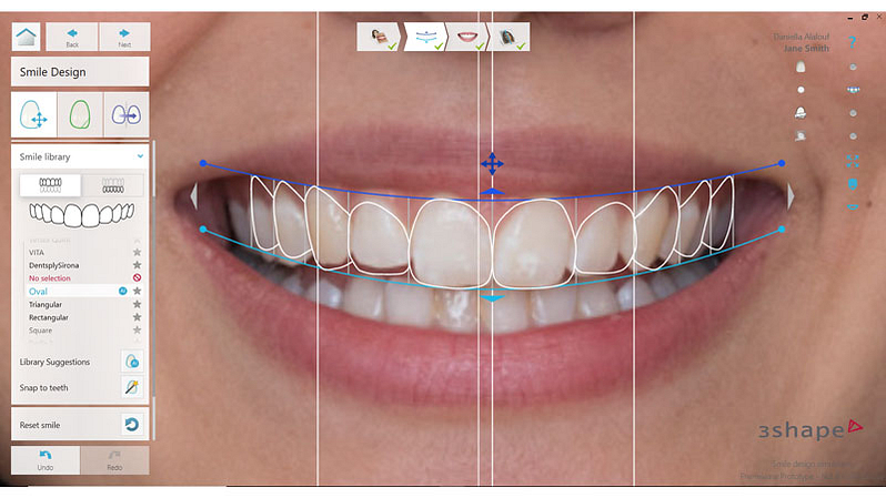 3Shape TRIOS 5 Intraoral Scanner Review