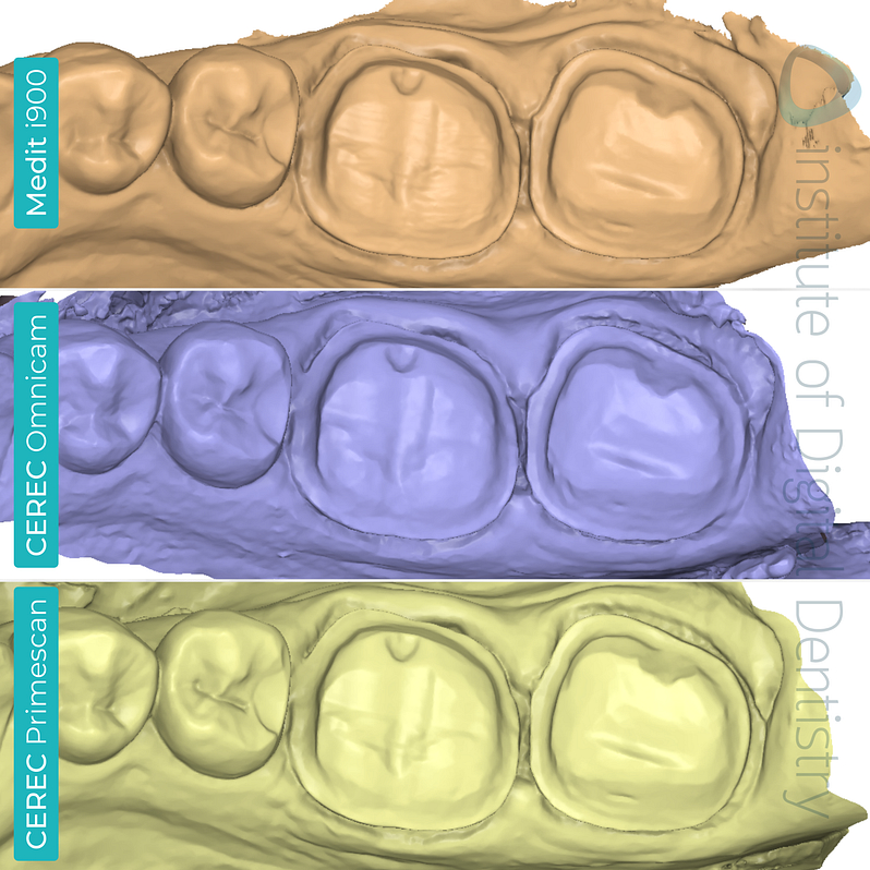 CEREC Omnicam vs. CEREC Primescan vs. Medit i900