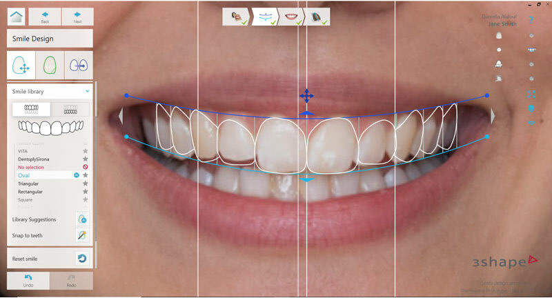 What is the Best 3Shape TRIOS Scanner?