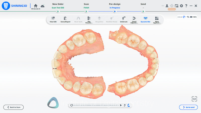 Shining 3D Aoralscan Elite Wireless Intraoral Scanner Review