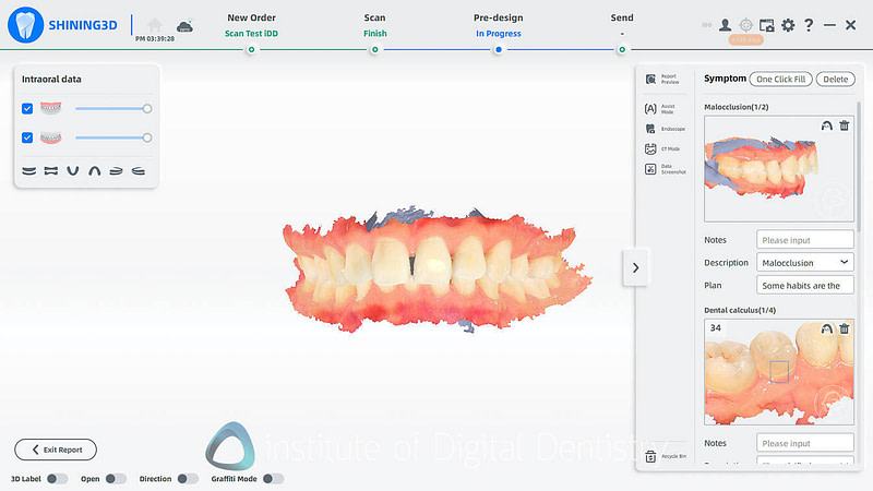 Shining 3D Aoralscan Elite Wireless Intraoral Scanner Review - iDD