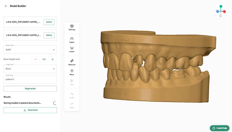 Straumann SIRIOS X3 Intraoral Scanner Review by iDD
