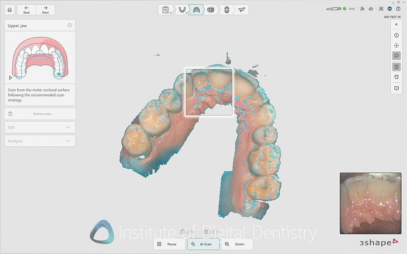 3Shape TRIOS 6 Intraoral Scanner Review by iDD
