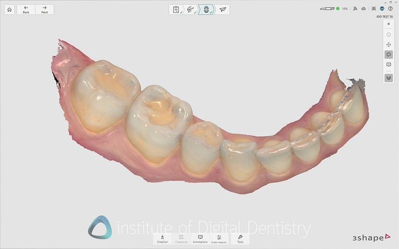 3Shape TRIOS 6 Intraoral Scanner Review by iDD