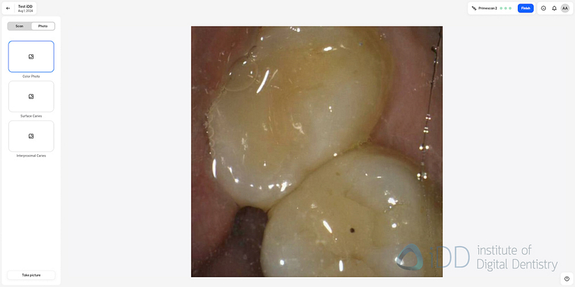 Primescan 2 Intraoral Scanner Review by iDD