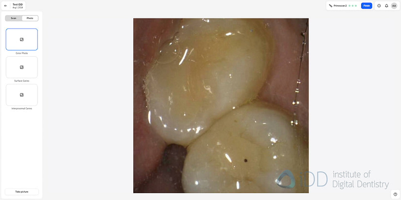 Primescan 2 Intraoral Scanner Review by iDD