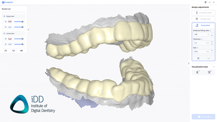 Aoralscan 3 Wireless Intraoral Scanner Review
