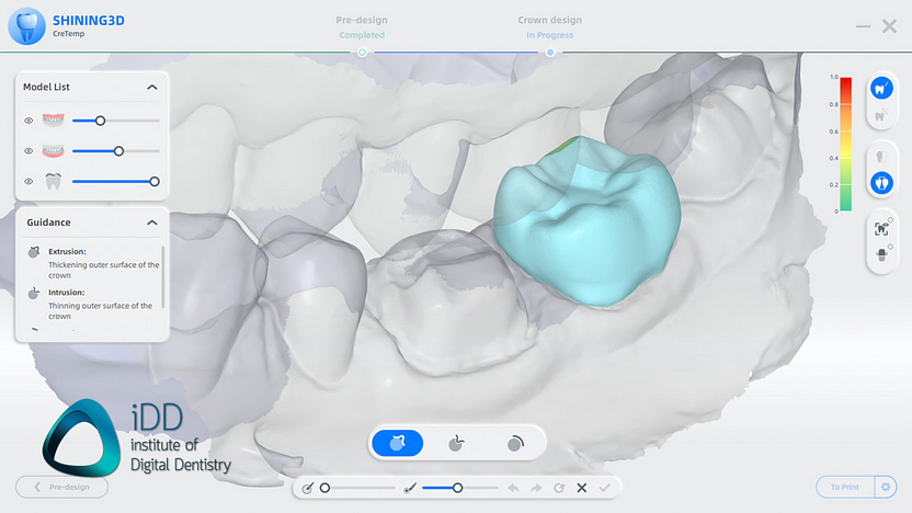 Aoralscan 3 Wireless Intraoral Scanner Review