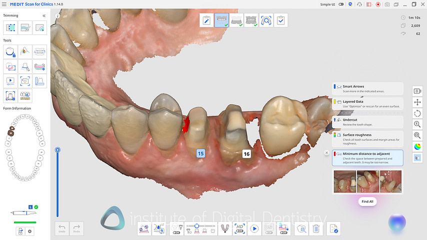 Medit Realtime Intelligence - AI Scan and Prep Review | iDD