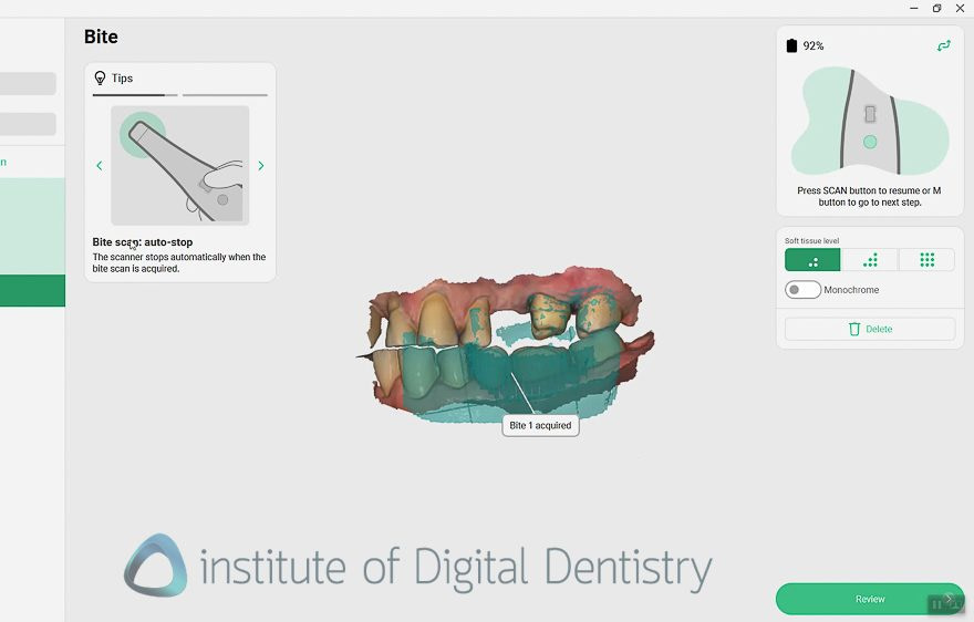 Straumann SIRIOS Intraoral Scanner Review by iDD