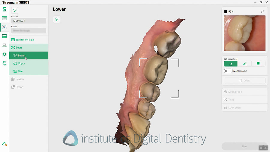 Straumann SIRIOS Intraoral Scanner Review by iDD