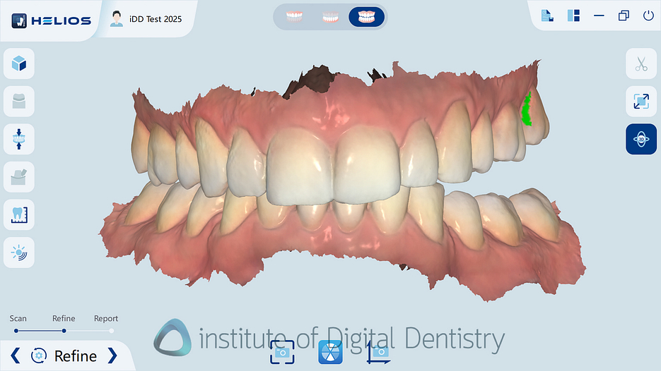 Helios 500 Intraoral Scanner Review