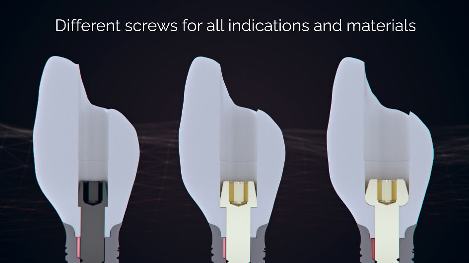 Understanding Prosthetic Screw Designs for Full-Arch Implants