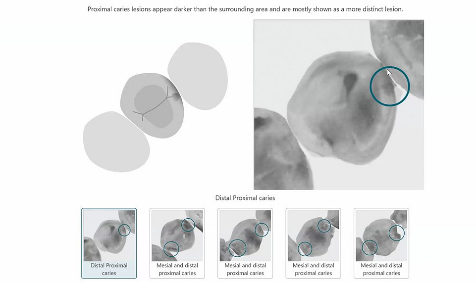 The New 3Shape TRIOS 6 is Launched. All details here.